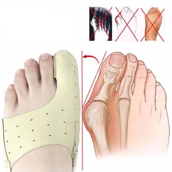 Adjustable Bunion Corrector - Best Price on Goombara