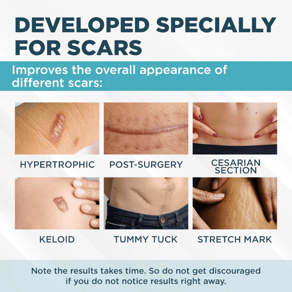 ClearScar™ Advanced Scar Reduction Gel - Not Sold In Stores