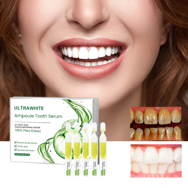 UltraWhite™ Tooth whitening and cleaning essence - Not Sold In Stores