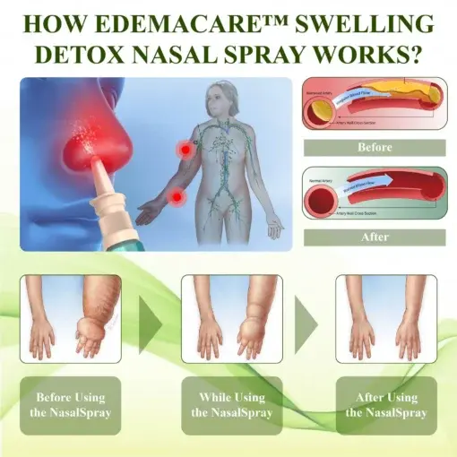 EdemaCare™ SwellingDetox Nasal Spray - Not Sold In Stores